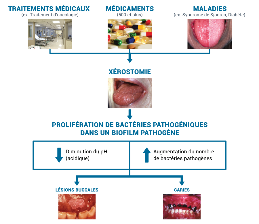 Lésions Buccales | Oral Science